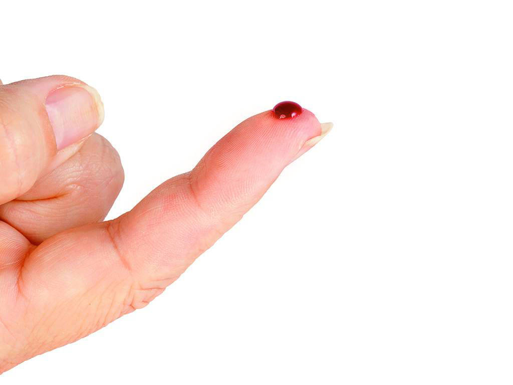 NutriSmart Allergen Finger Blood Drop Test - Green Queen